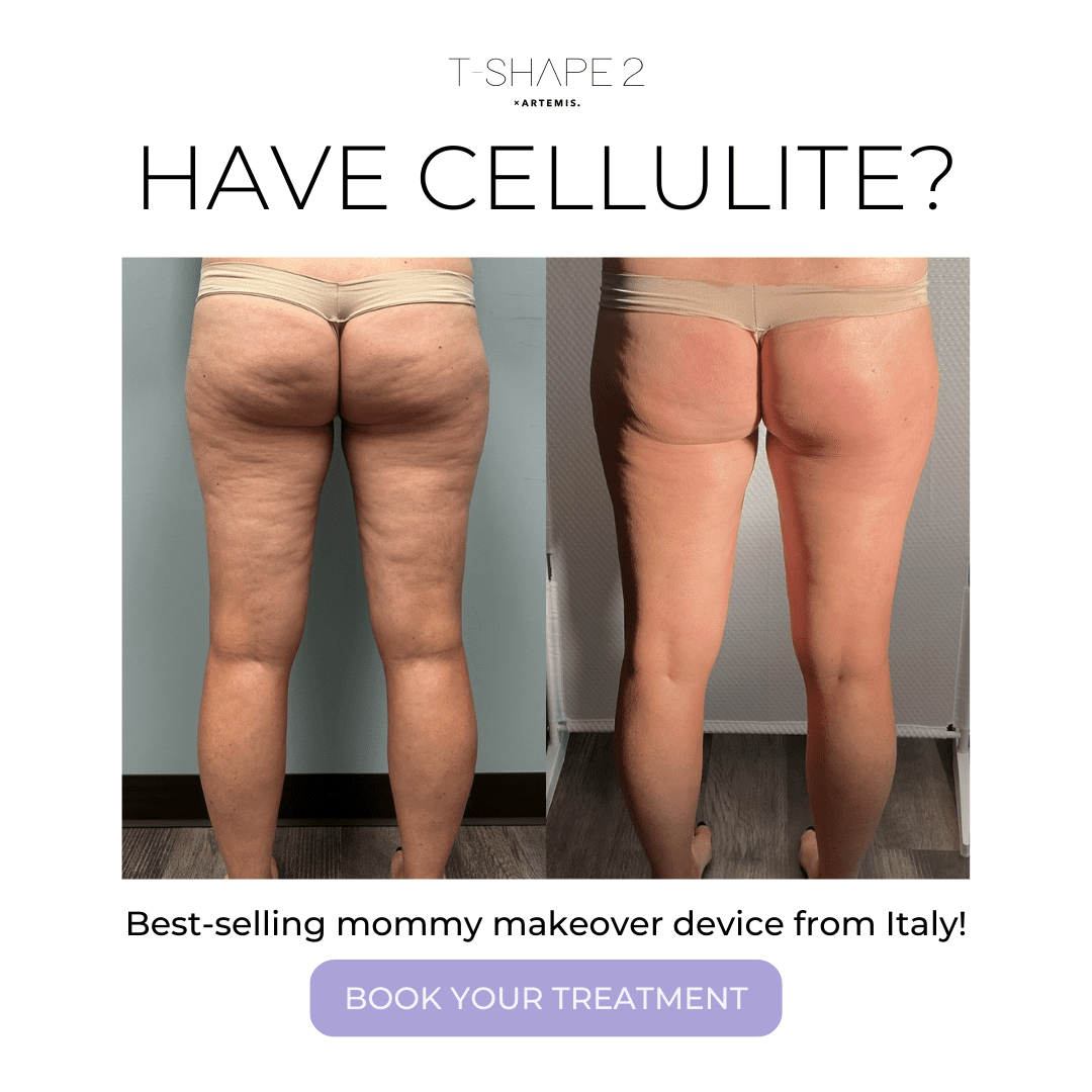 Massage – Cupping – Lymph Drainage | Harmony Hormone Solutions